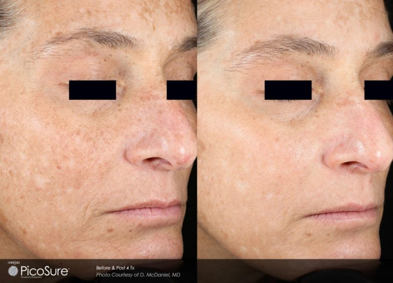 » Skin Rejuvenation